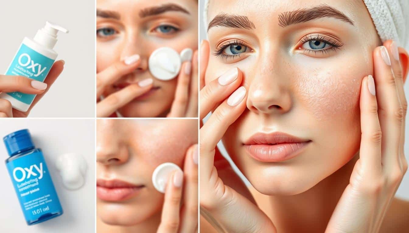 How to Use Oxy Acne Treatment: Clear Skin Guide – Beauty Nails Salon ...